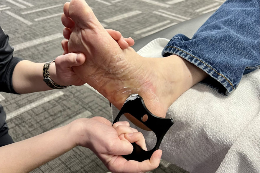 Instrument Aided Soft Tissue Mobilization · Witte Physical Therapy ...